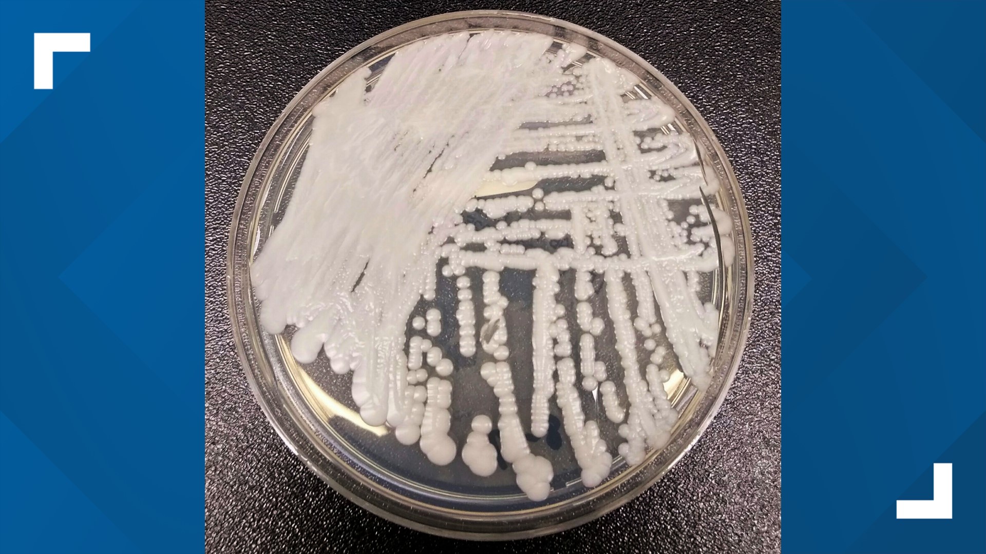 Candida auris: Drug-resistant fungus spreading in US, CDC says | wfaa.com