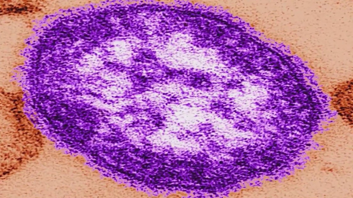 Houston confirms measles case in Hobby airport traveler | wfaa.com