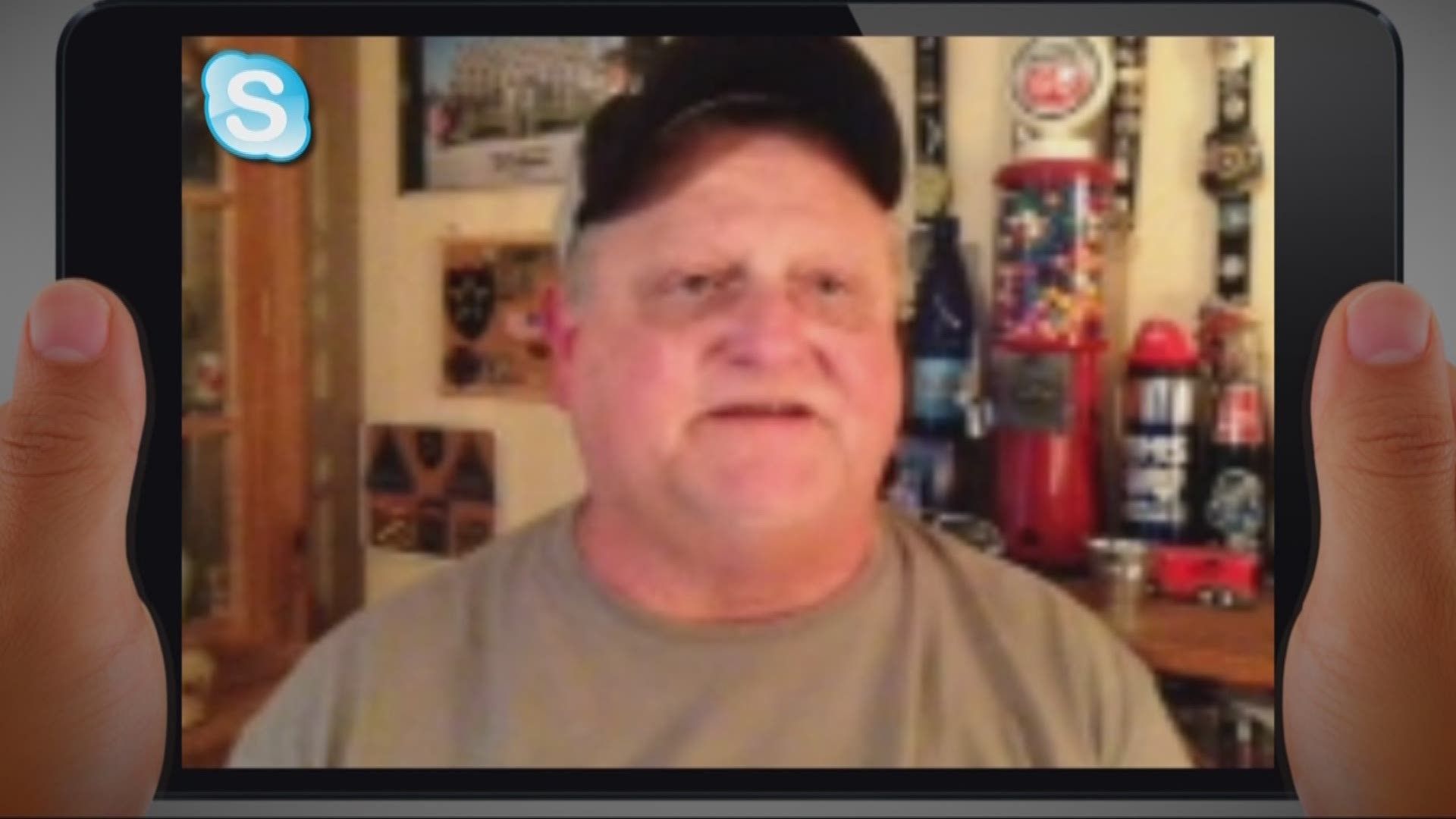 Fur Clad Tourist Said He Was Mistaken For Bigfoot Wfaa fur-clad-tourist-said-he-was-mistaken-for-bigfoot-wfaa