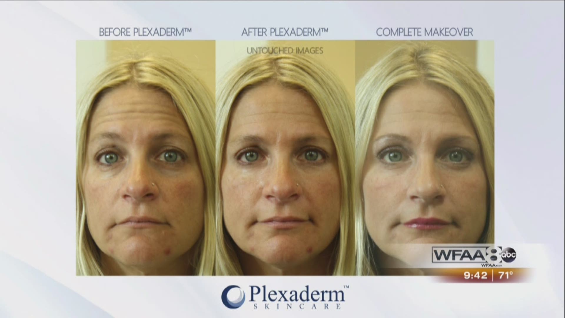 The beauty and ease of Plexaderm Skin Care | wfaa.com