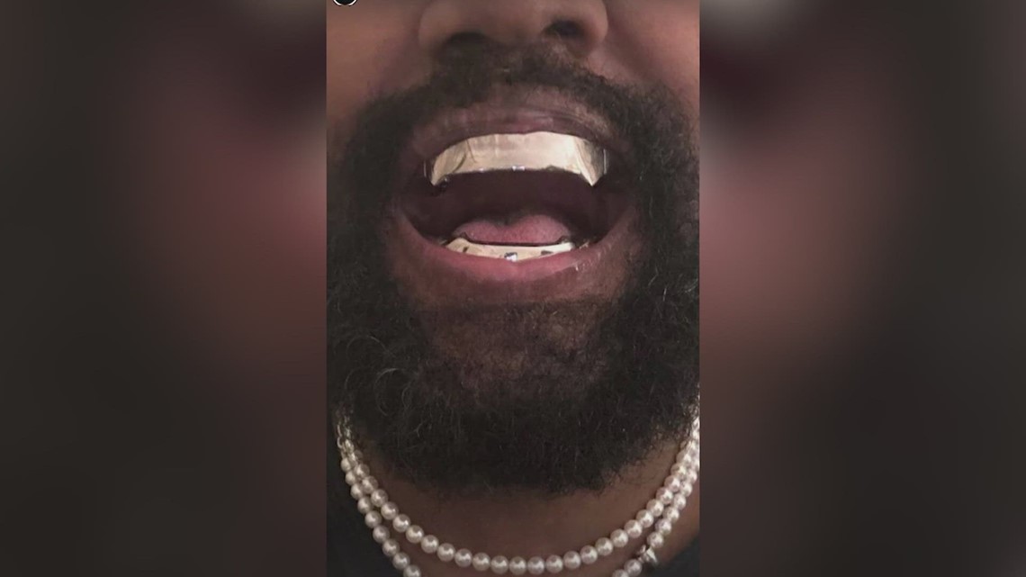 Ye's new grillz sparks rumors of him getting teeth removed | wfaa.com