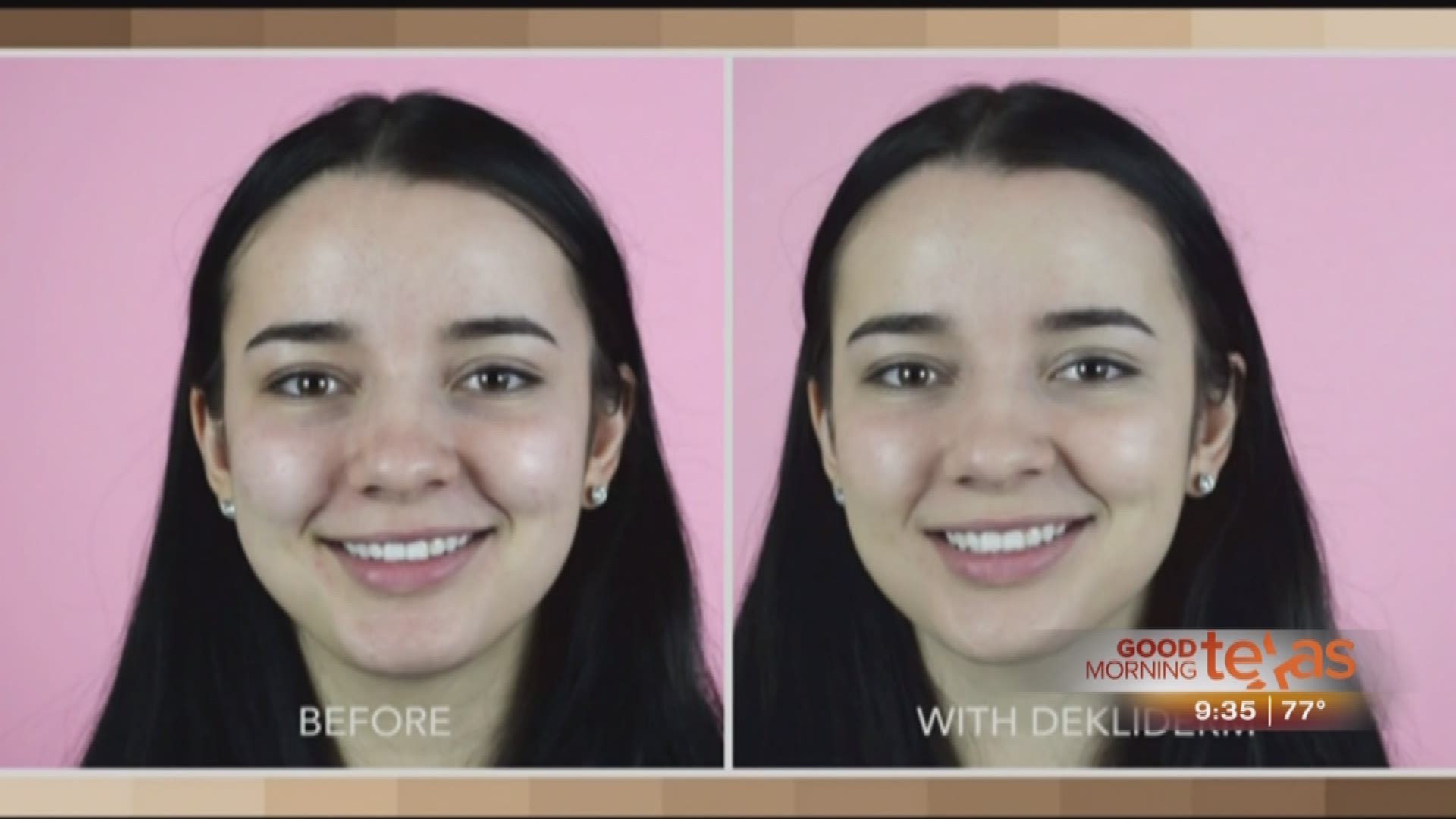 See the beauty of Dekliderm! The skin care foundation of the future ...
