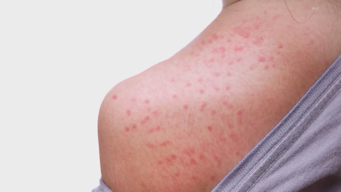 Luke Kwon golf cart accident: Texas golfer makes his recovery | wfaa.com