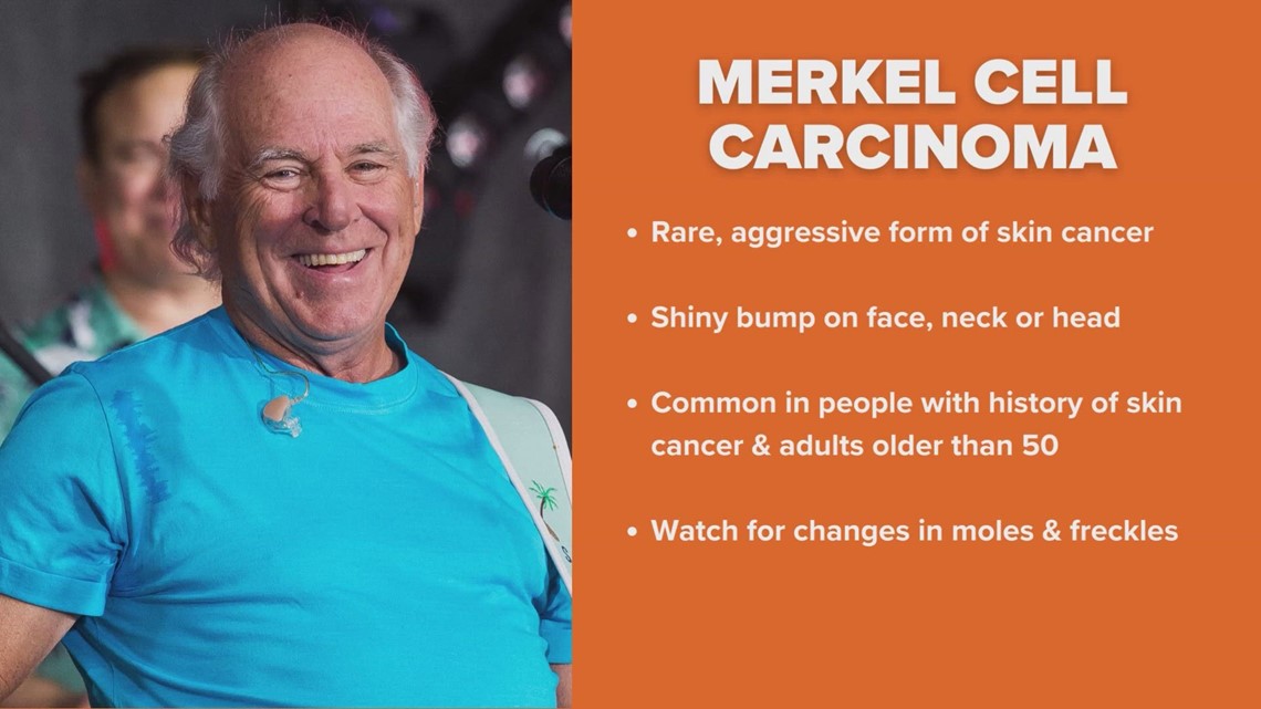 Jimmy Buffet death: What is Markel cell carcinoma? | wfaa.com