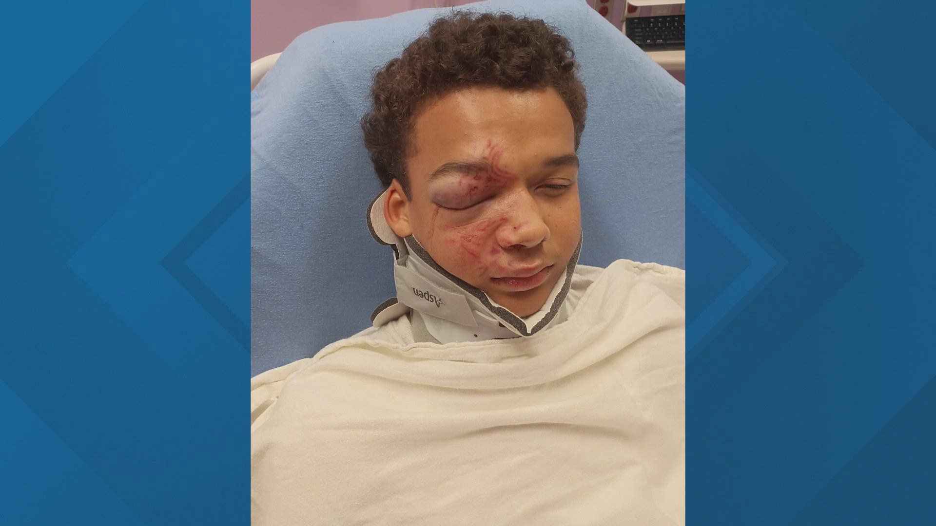 Dallas officer arrested for assaulting detained teen in custody | wfaa.com