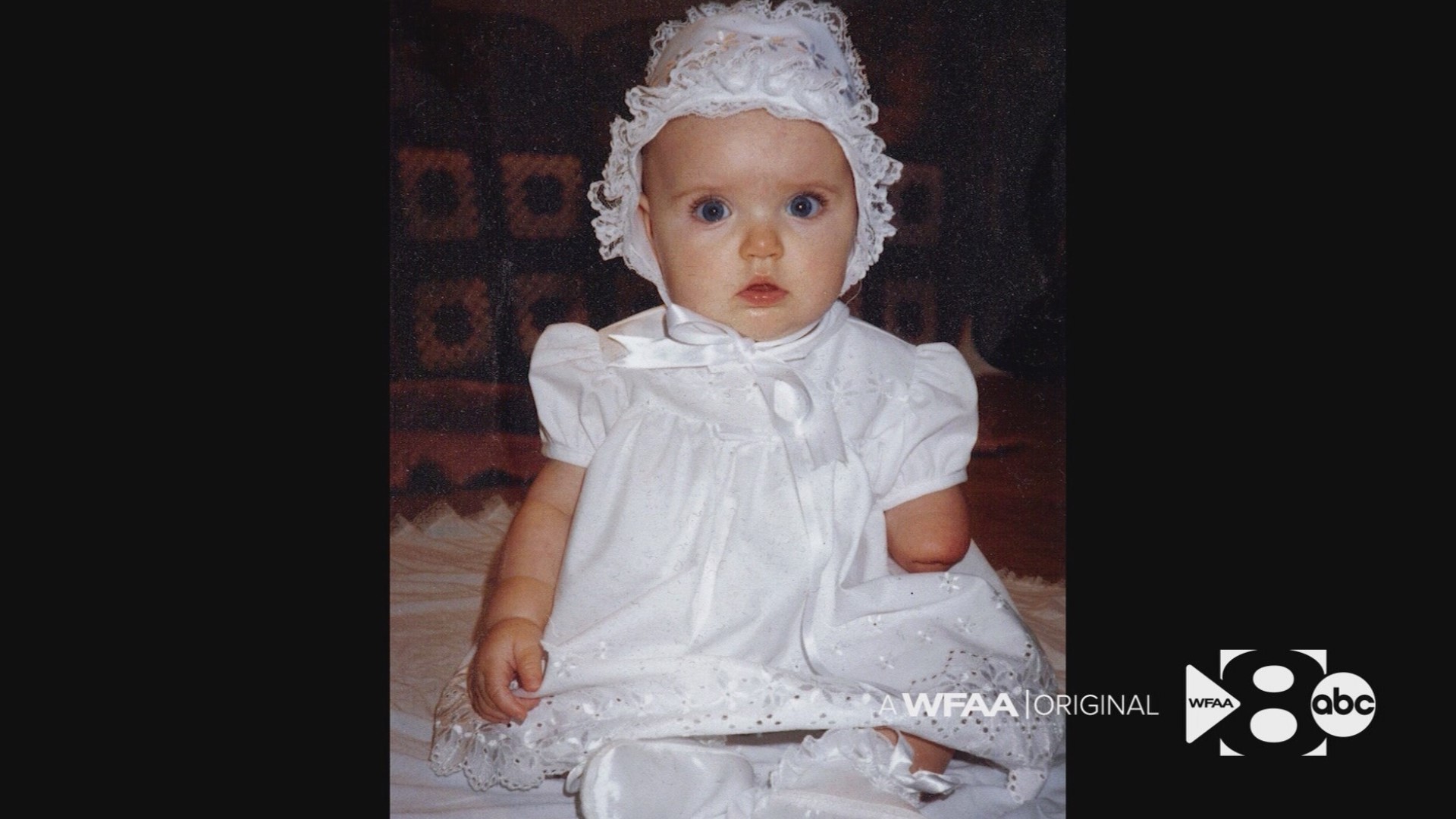 'No one can tell you that you can't': Fort Worth medical student born ...