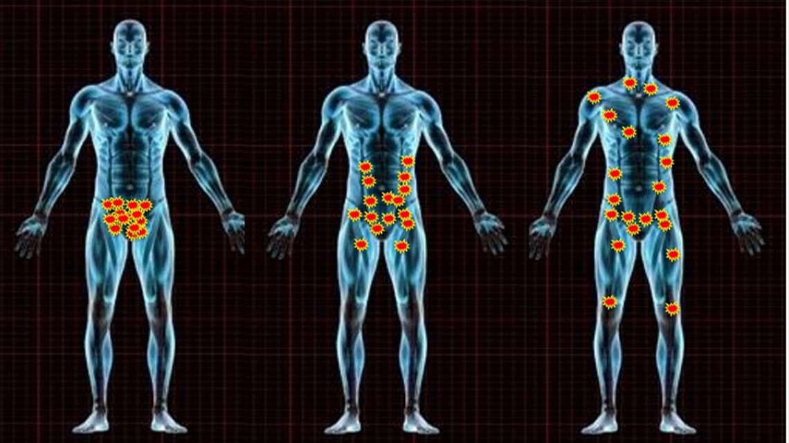 'Roach motel' for cancer cells: How UTA research could change cancer ...