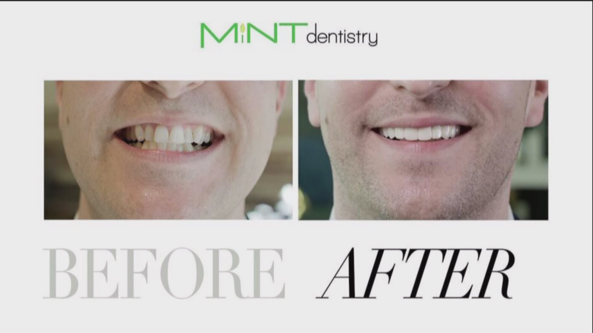 Why Get Sexy Teeth at MINT Dentistry | wfaa.com