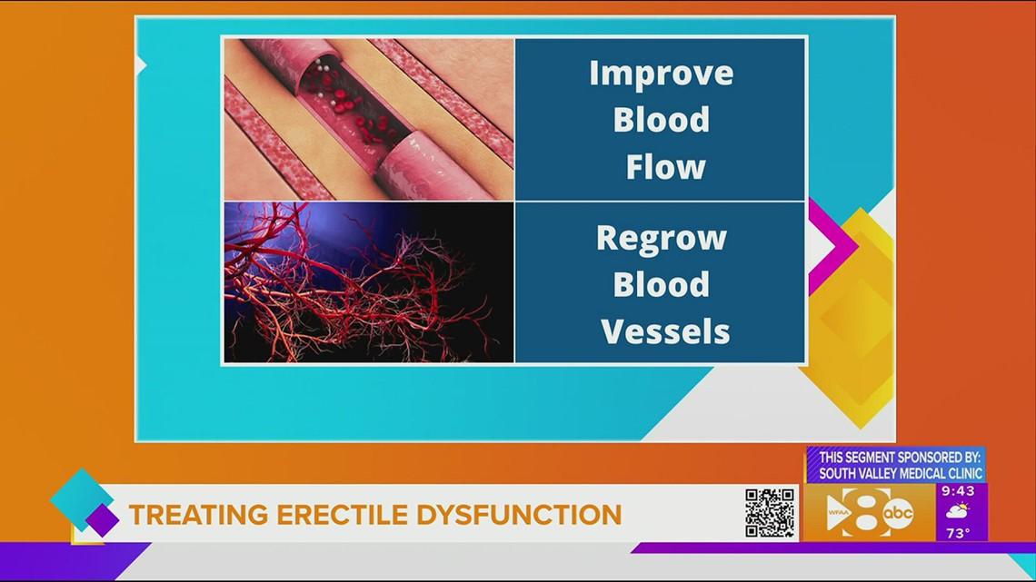 Treating erectile dysfunction | wfaa.com