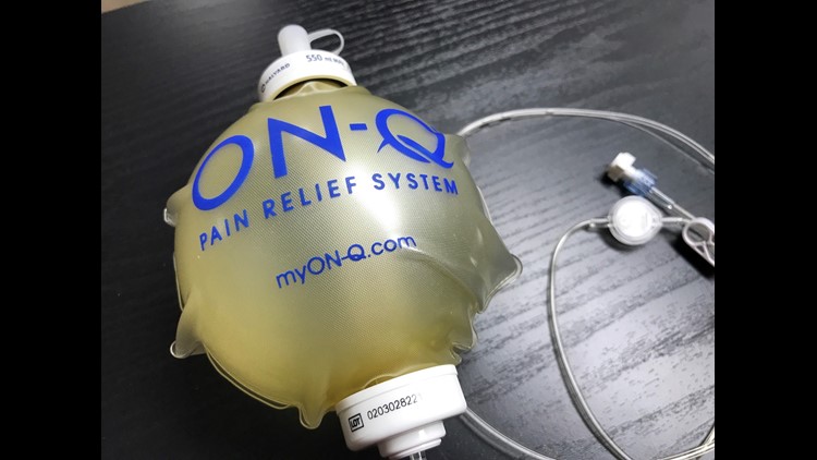 A pain-free C-section: How can major surgery require no prescription ...