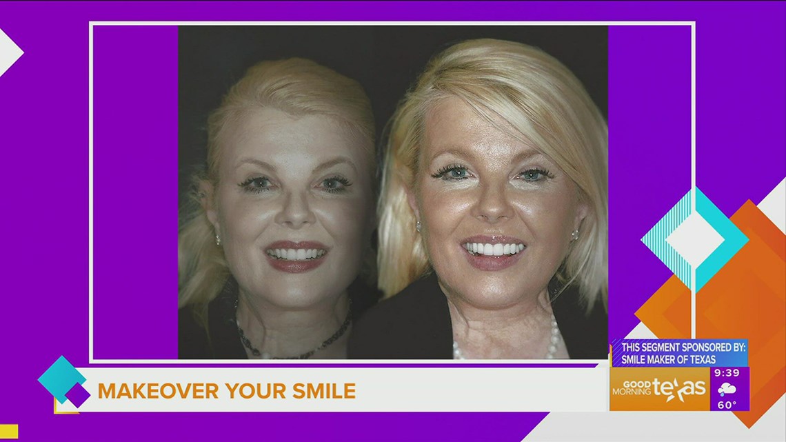 Makeover your smile at Smile Maker of Texas | wfaa.com