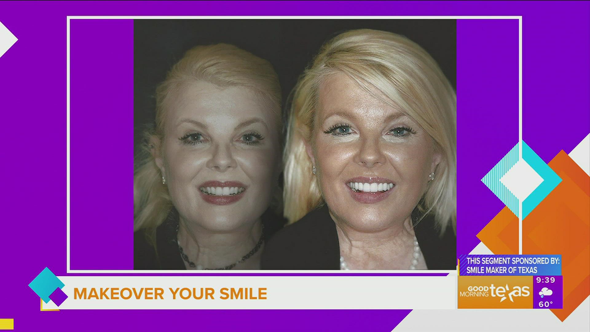 Makeover your smile at Smile Maker of Texas | wfaa.com