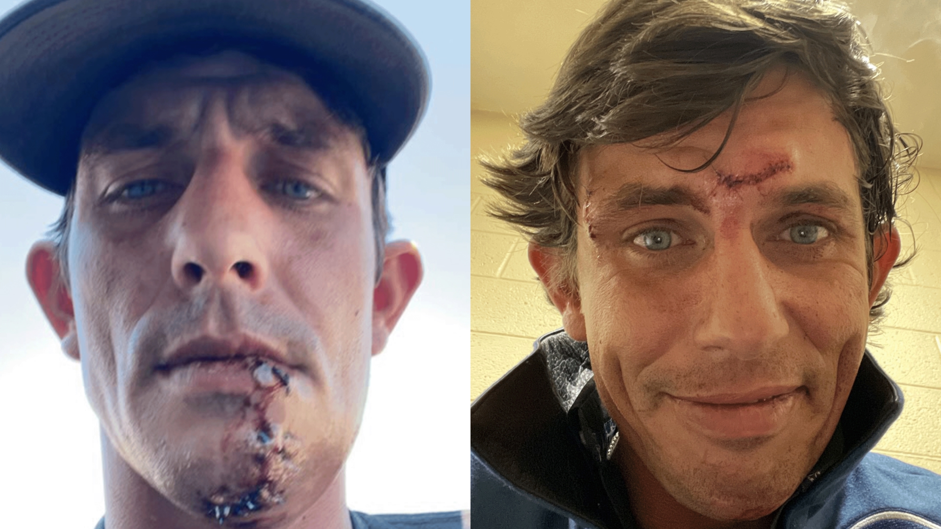 J.B. Mauney reflects on career, bull ride that broke his neck | wfaa.com