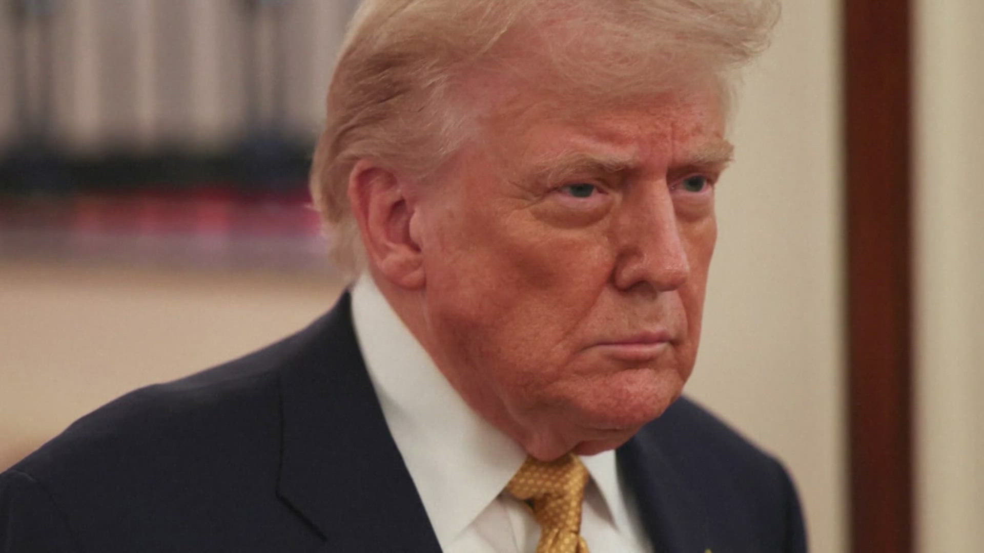 What is chronic venous insufficiency? Why President Trump had a health ...