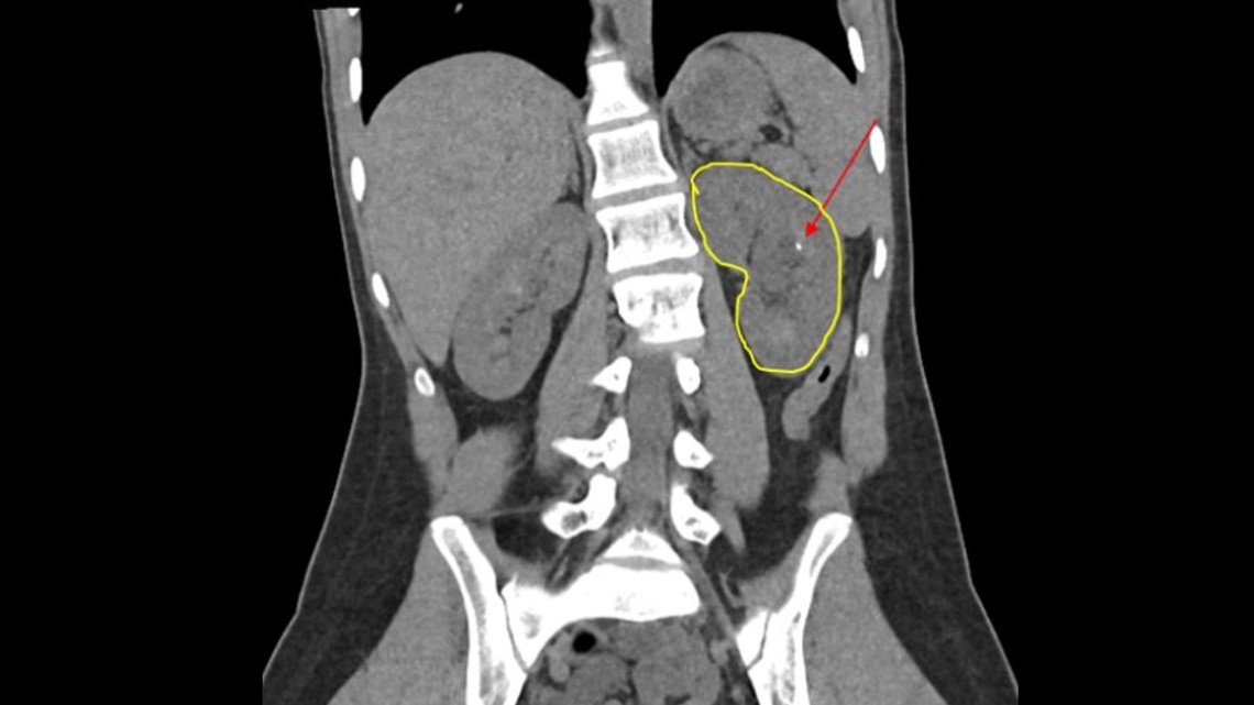 What is the Stone Belt in Texas? | wfaa.com