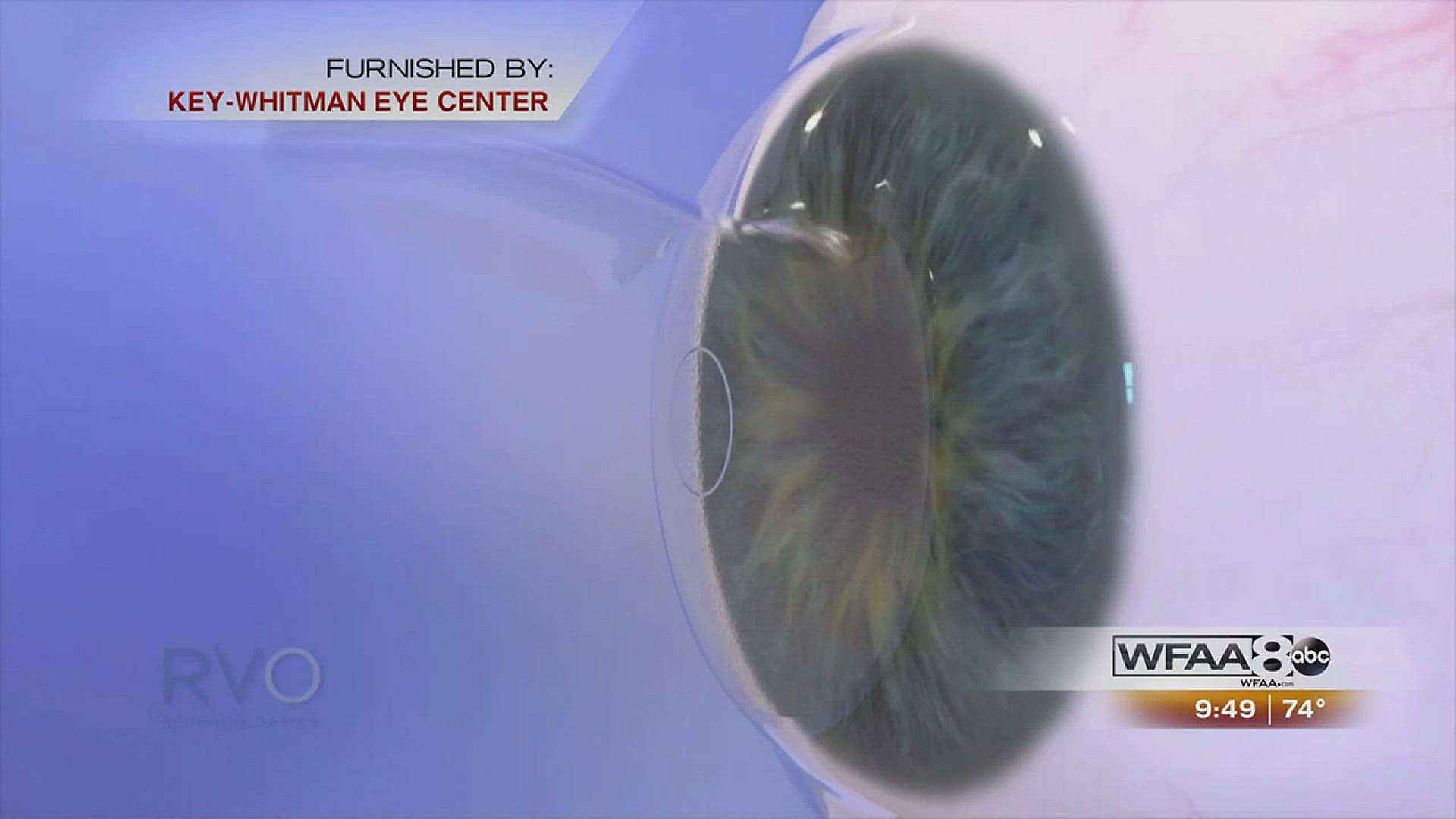How Raindrop Procedure Can Help Reading Vision | wfaa.com