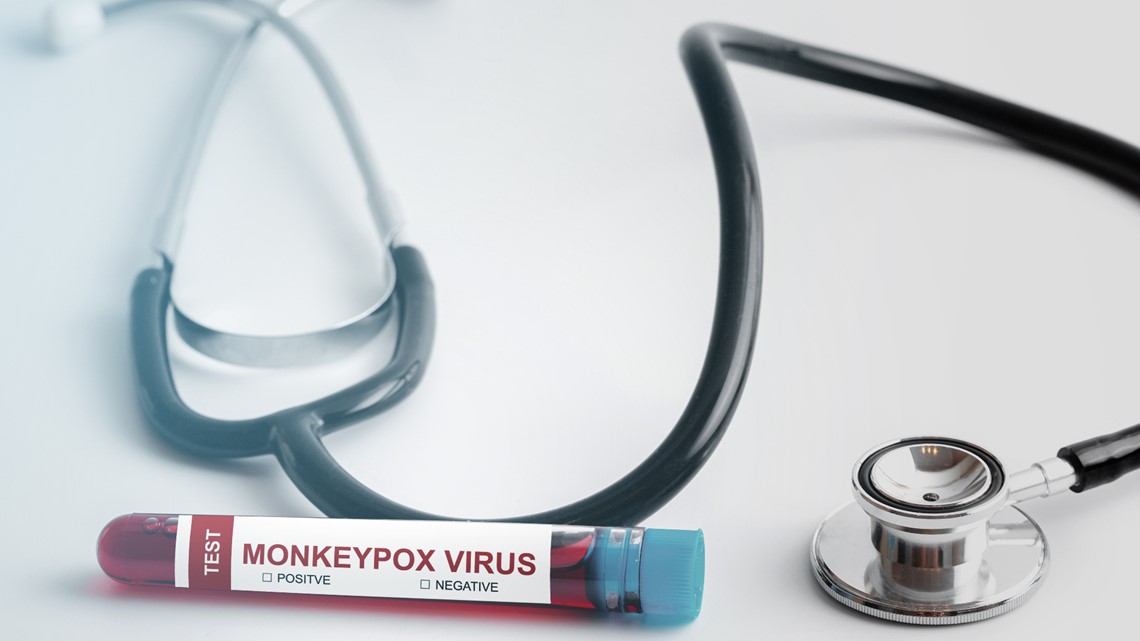 Dallas County Monkeypox deaths: 2 reported | wfaa.com