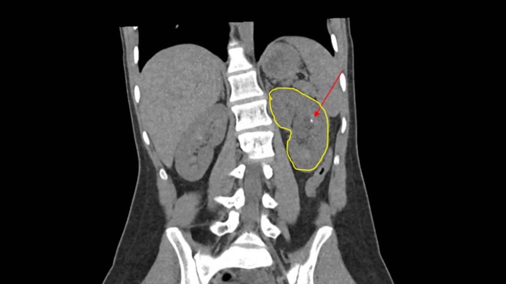 What is the Stone Belt in Texas? | wfaa.com
