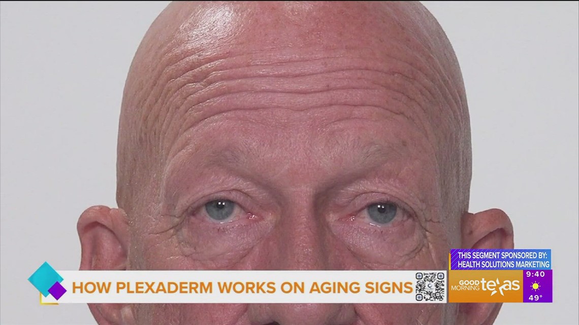 Sponsored: How Plexaderm works on aging signs | wfaa.com